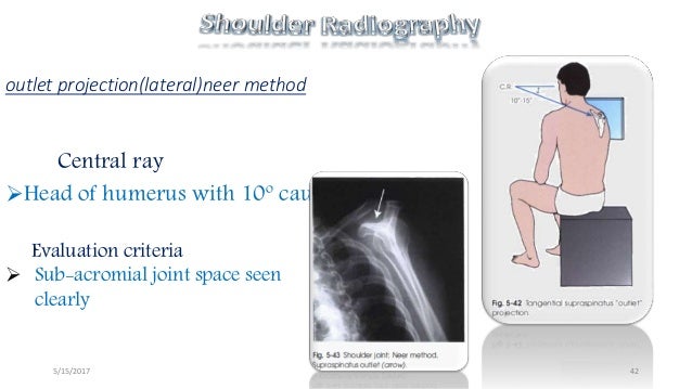 Shoulder radiography avinesh shrestha