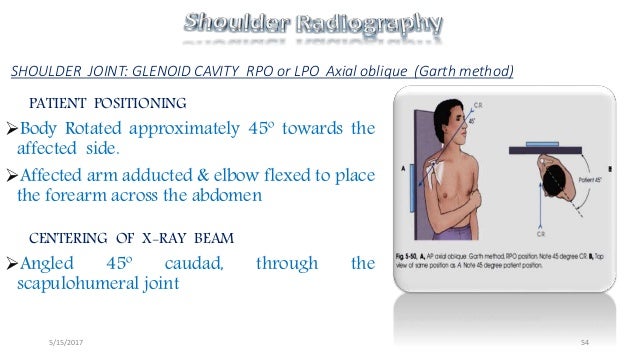 Shoulder radiography avinesh shrestha