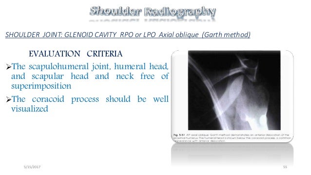 Shoulder radiography avinesh shrestha
