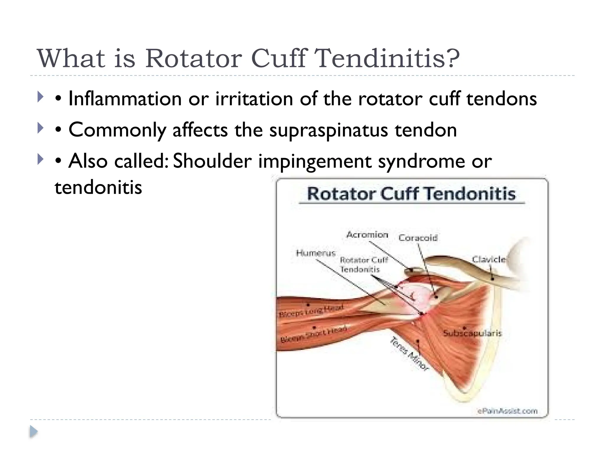 Shoulder_RC_Tendinitis_Physio___PPT.pptx
