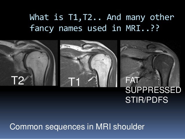 MRI OF SHOULDER INJURY