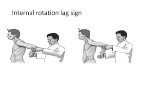 Shoulder special tests-pictoral | PPTX