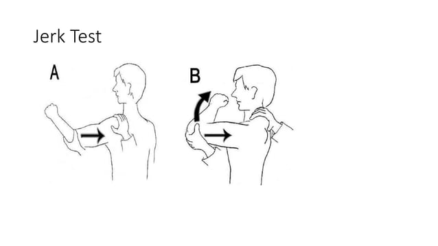 Shoulder special tests-pictoral | PPT