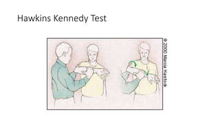 Shoulder special tests-pictoral | PPTX