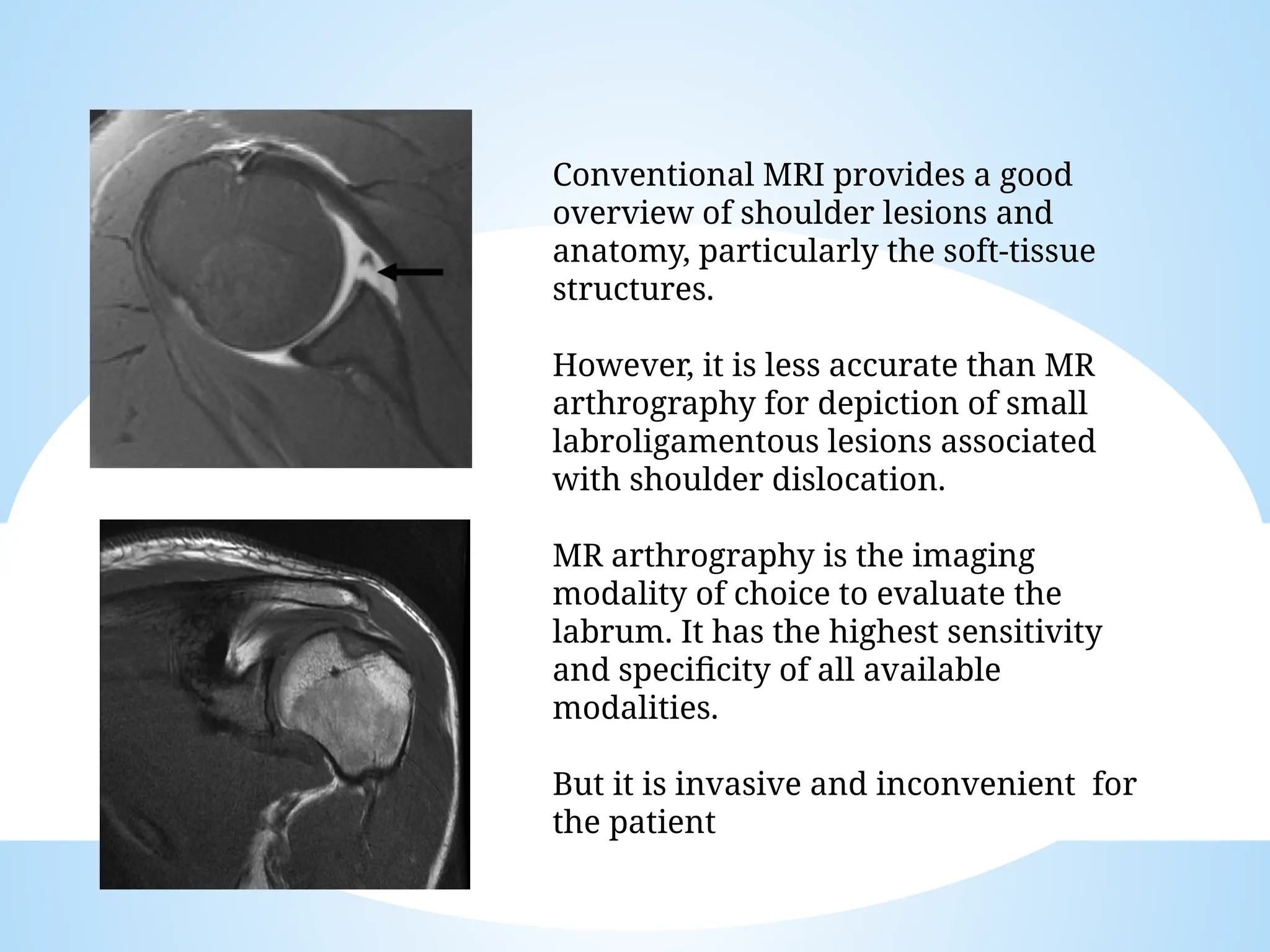 shoulder sports injuries ppt knee and shoulder | PPTX