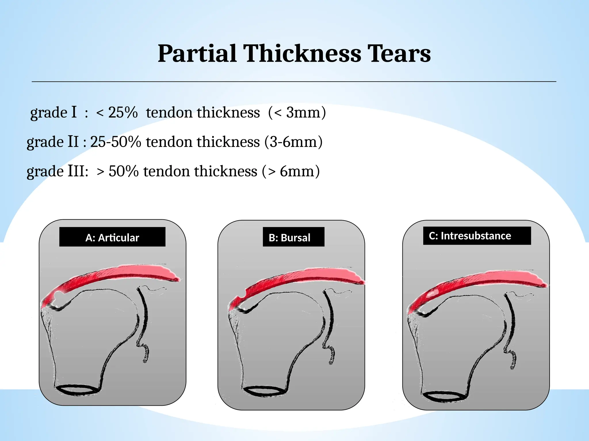 shoulder sports injuries ppt knee and shoulder | PPTX
