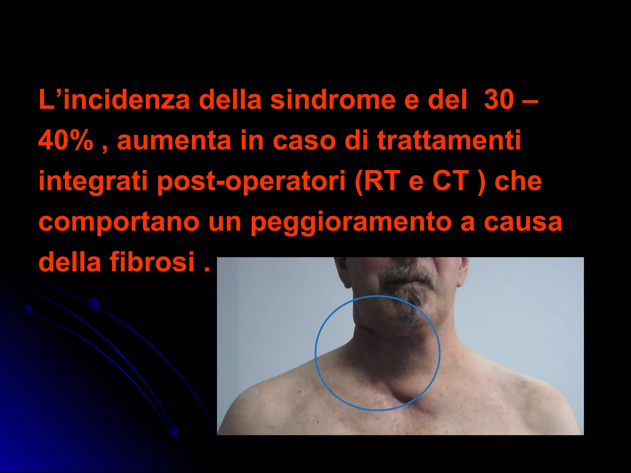 Shoulder syndrome | PPT | Death, Injury, or Military Conflict ...