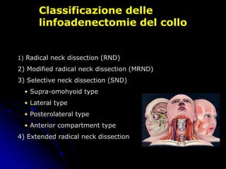 Shoulder syndrome nello svuotamento linfonodale latero-cervicale | PPT