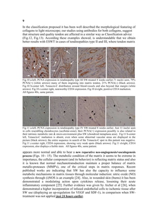Shoulder Tendinopathy.31.12.09