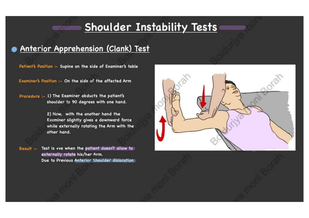 Shoulder Special Tests Guide + Diagnosis | PPTX