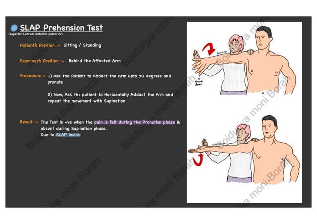 Shoulder Special Tests Guide + Diagnosis | PPTX