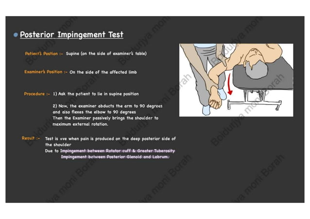 Shoulder Special Tests Guide + Diagnosis | PPTX