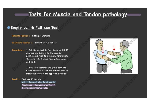 Shoulder Special Tests Guide + Diagnosis | PPTX
