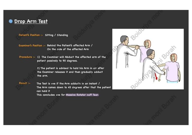 Shoulder Special Tests Guide + Diagnosis | PPTX