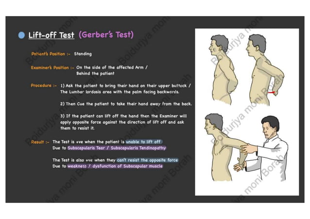 Shoulder Special Tests Guide + Diagnosis | PPTX