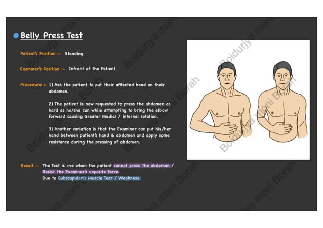 Shoulder Special Tests Guide + Diagnosis | PPTX