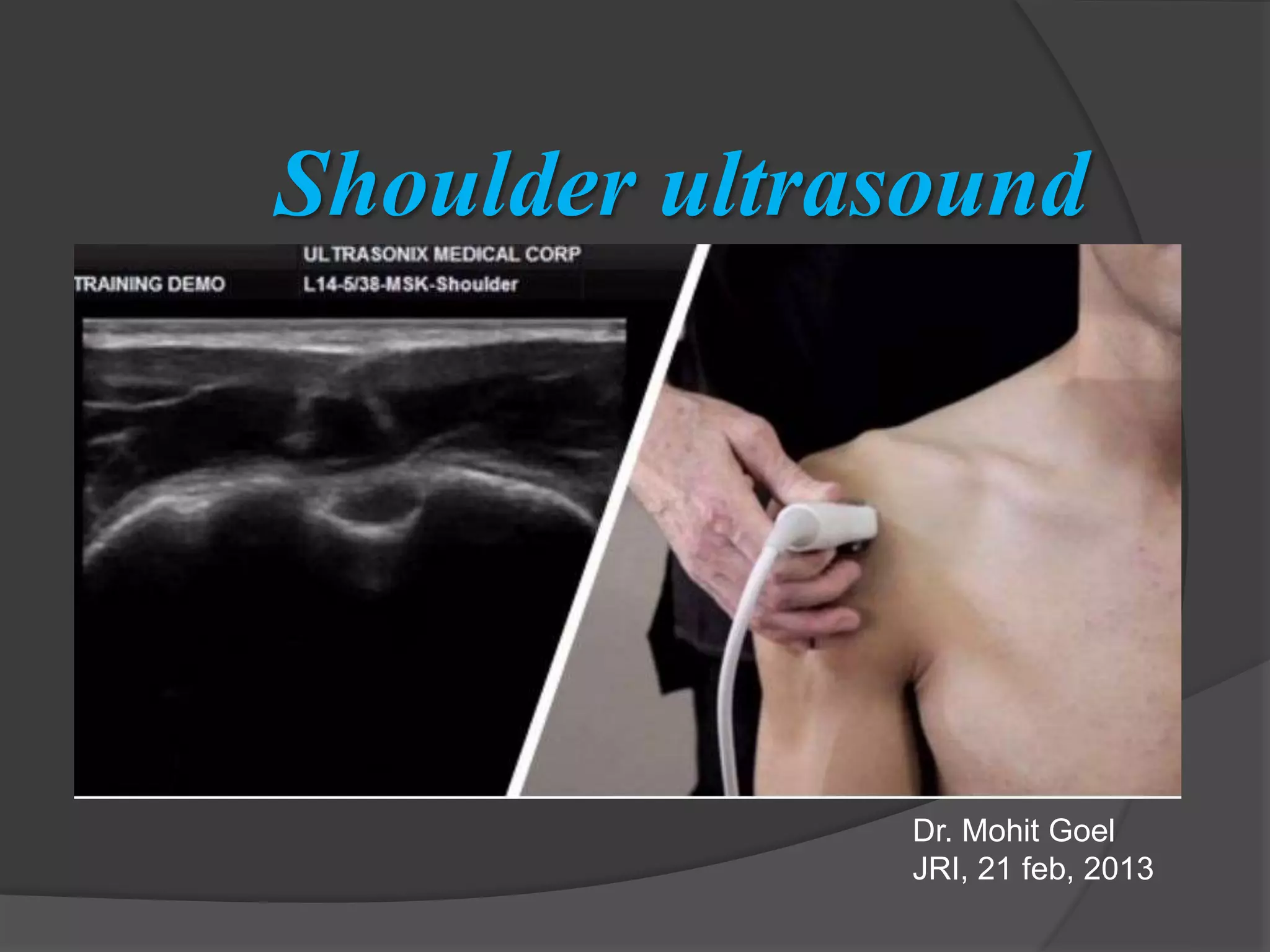 Shoulder ultrasound | PPTX