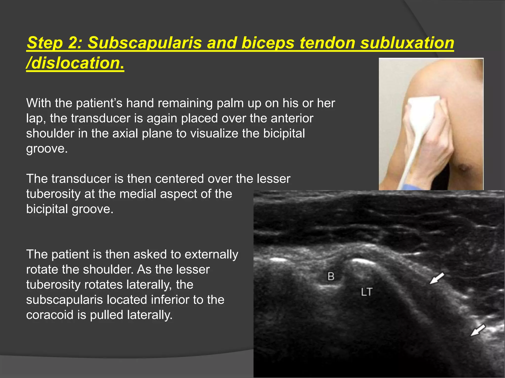 Shoulder ultrasound | PPTX