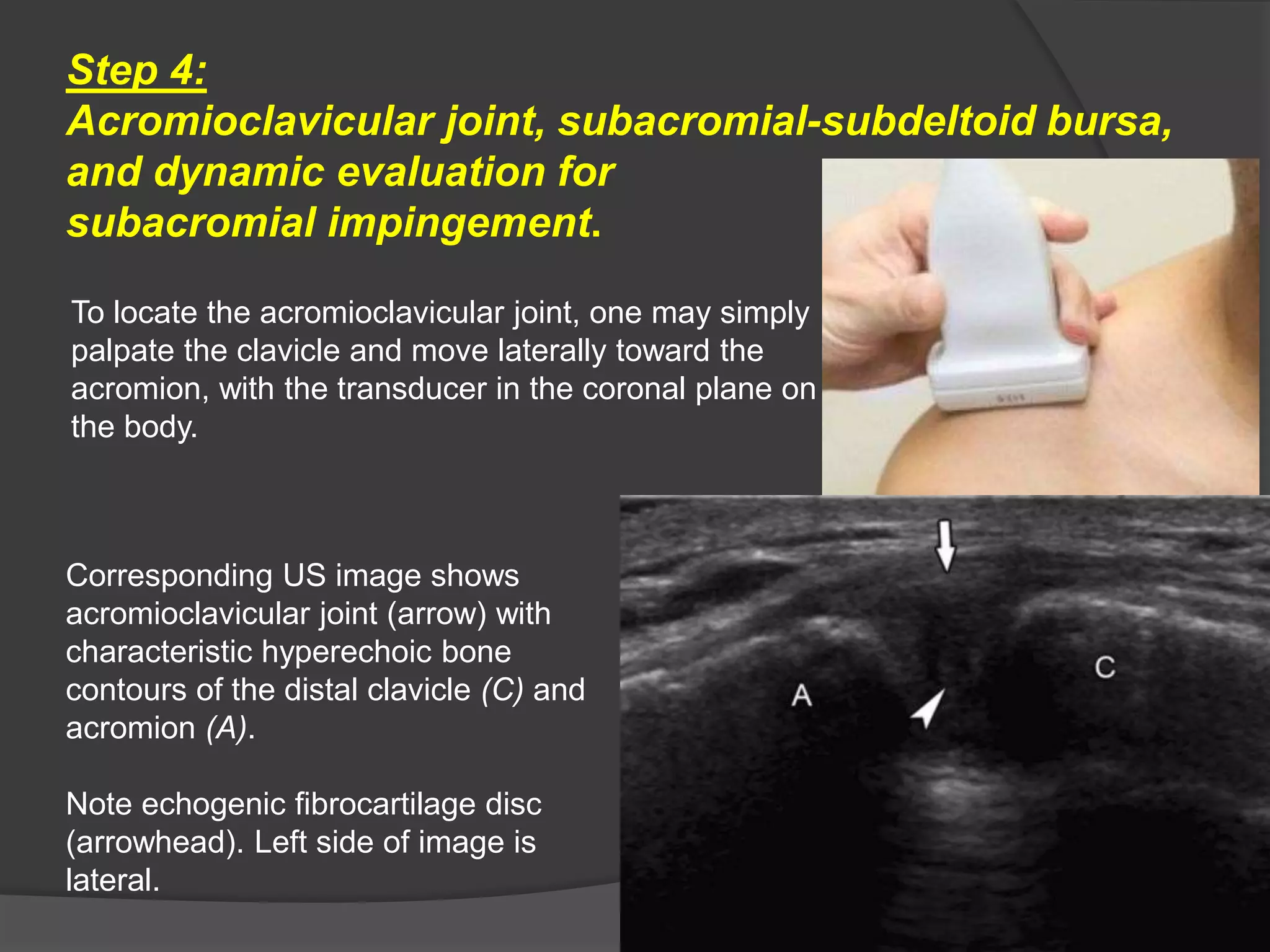 Shoulder ultrasound | PPTX