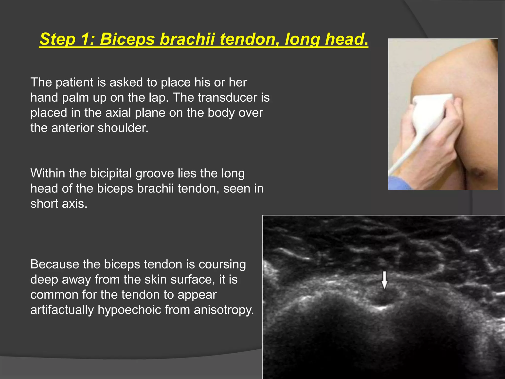Shoulder ultrasound | PPTX