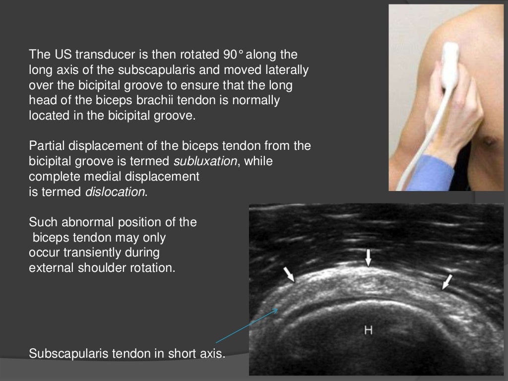 Shoulder ultrasound