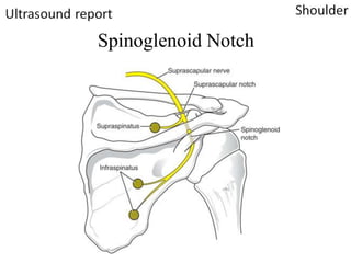 Shoulder ultrasound report | PDF