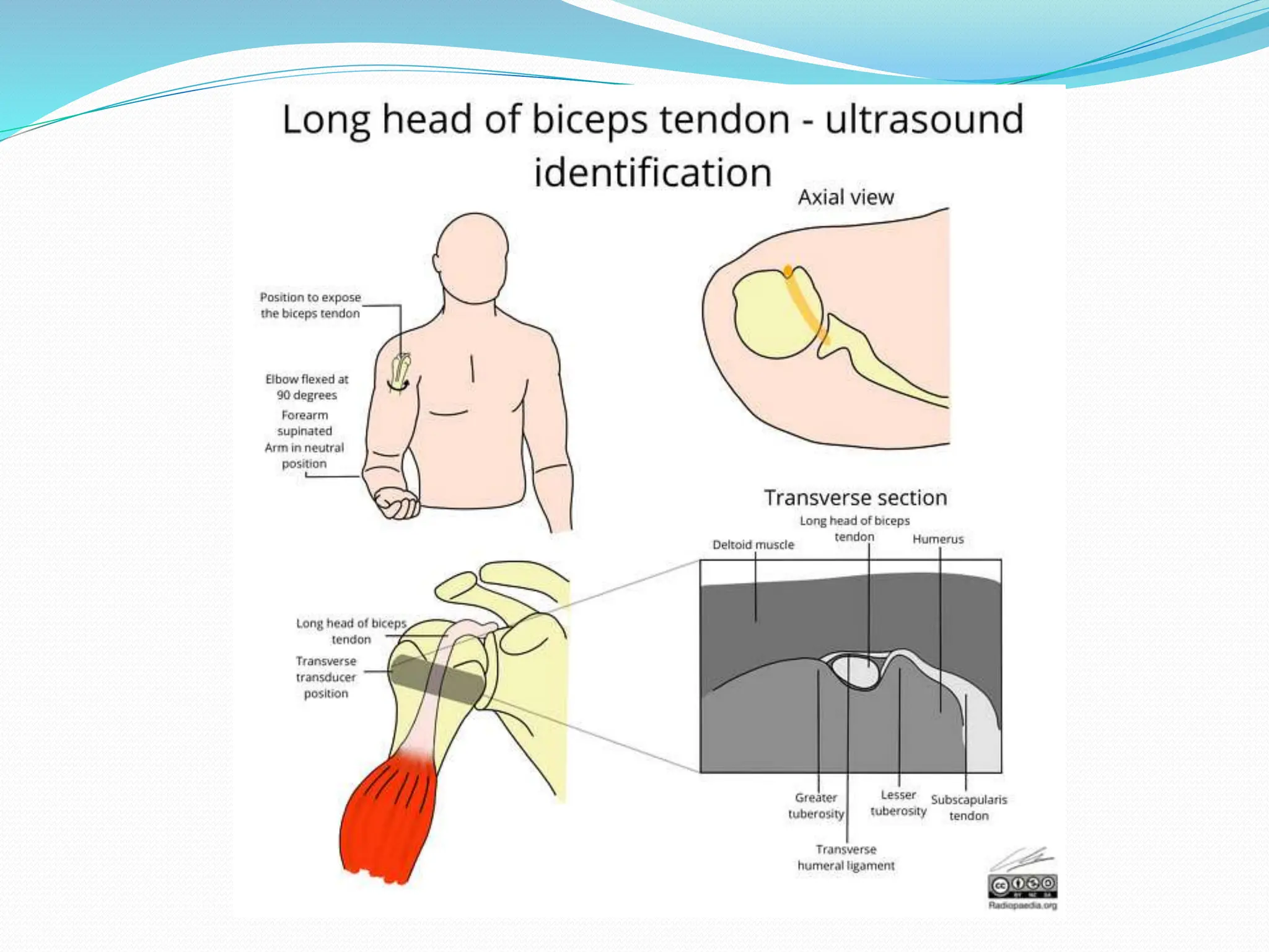 shoulder joint USG basics for begginers.pptx