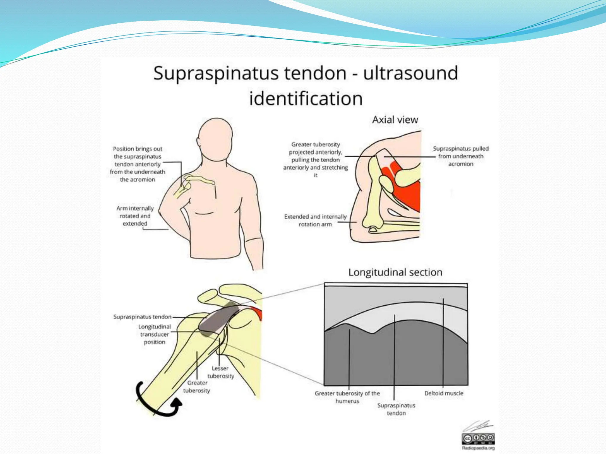 shoulder joint USG basics for begginers.pptx