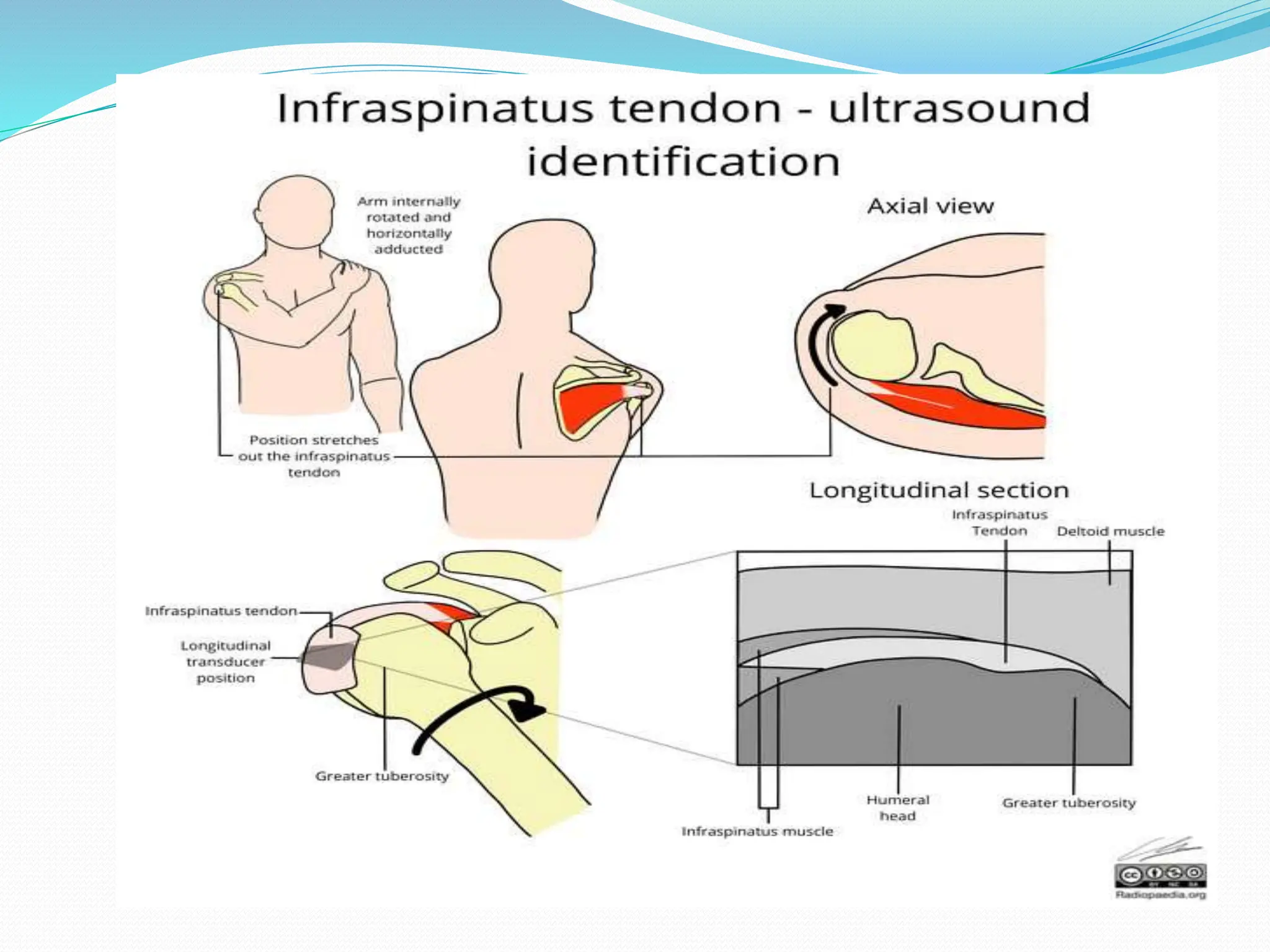 shoulder joint USG basics for begginers.pptx