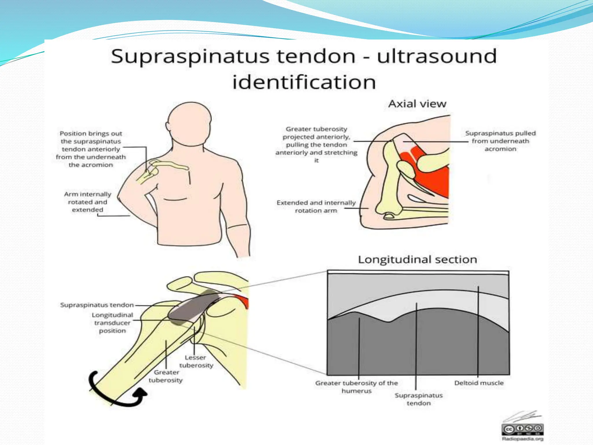shoulder joint USG basics for begginers.pptx