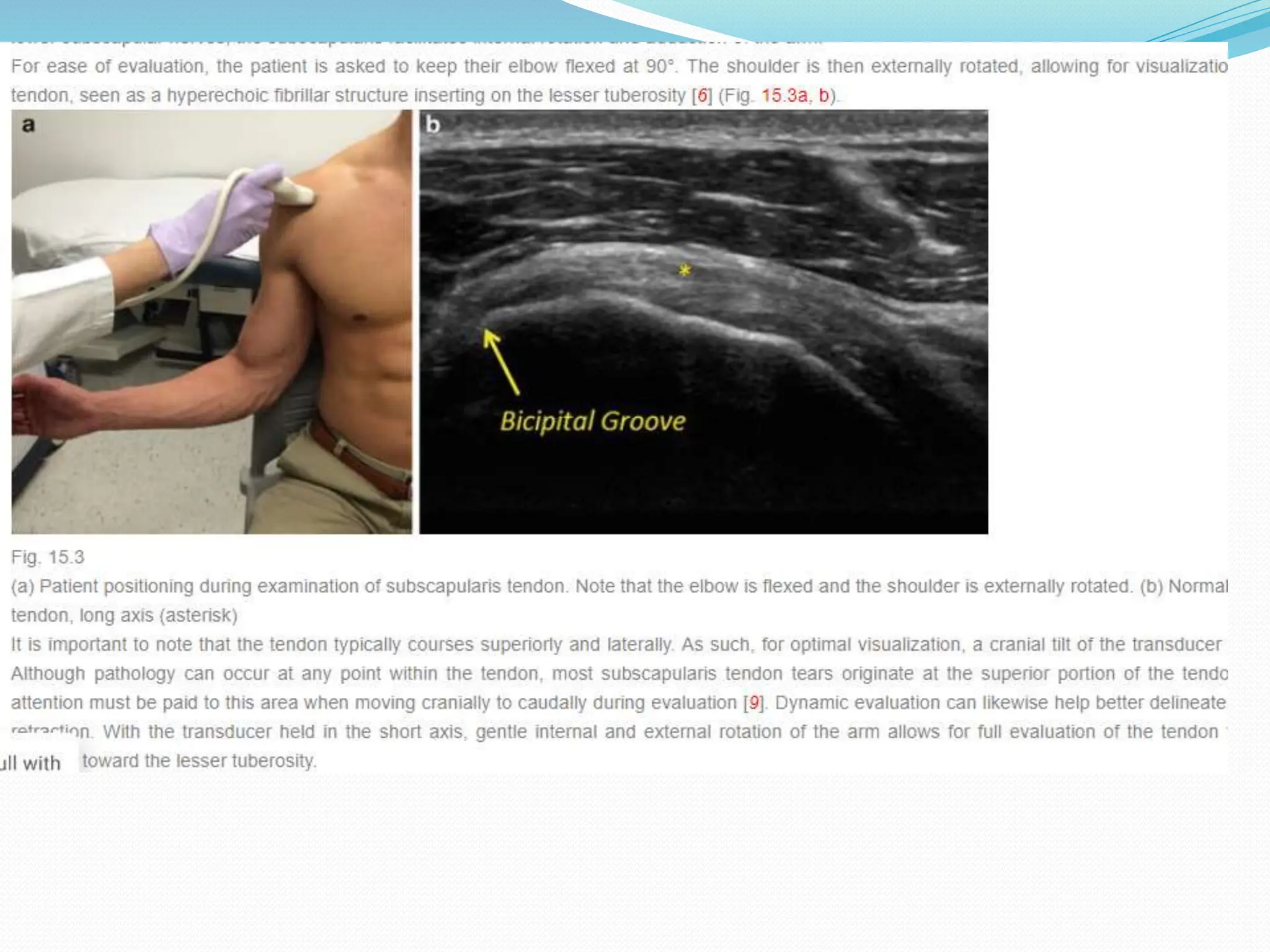 shoulder joint USG basics for begginers.pptx