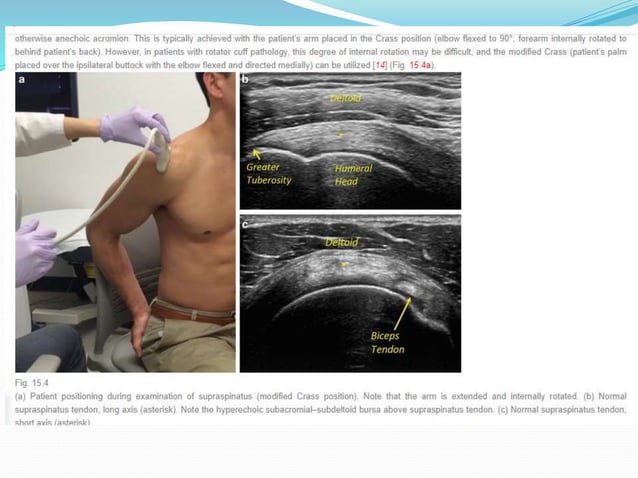shoulder joint USG basics for begginers.pptx