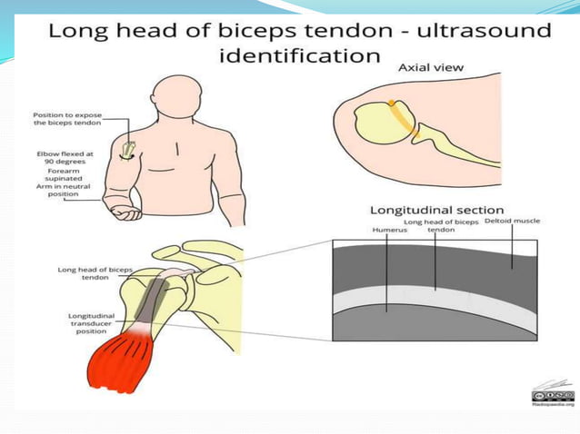 shoulder joint USG basics for begginers.pptx
