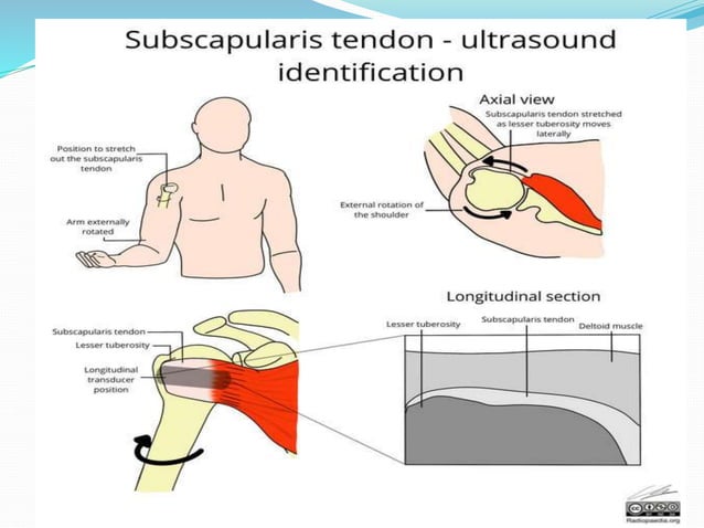 shoulder joint USG basics for begginers.pptx