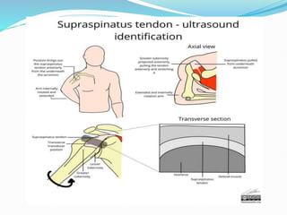 shoulder joint USG basics for begginers.pptx