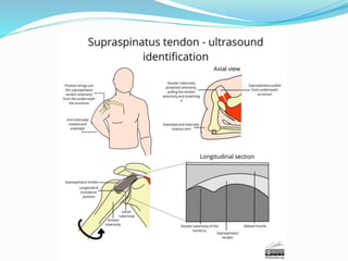 shoulder joint USG basics for begginers.pptx