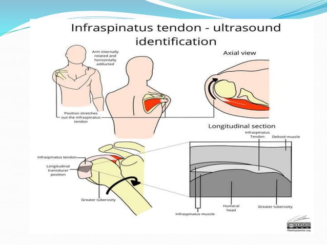 shoulder joint USG basics for begginers.pptx