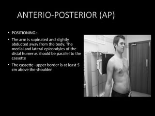 Shoulder Views --Sandra.pptx all imaging | PPTX