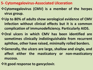 K-oral.m-Show infetious-diseases-i | PPT
