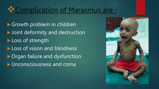 MALNUTRITION | PPTX