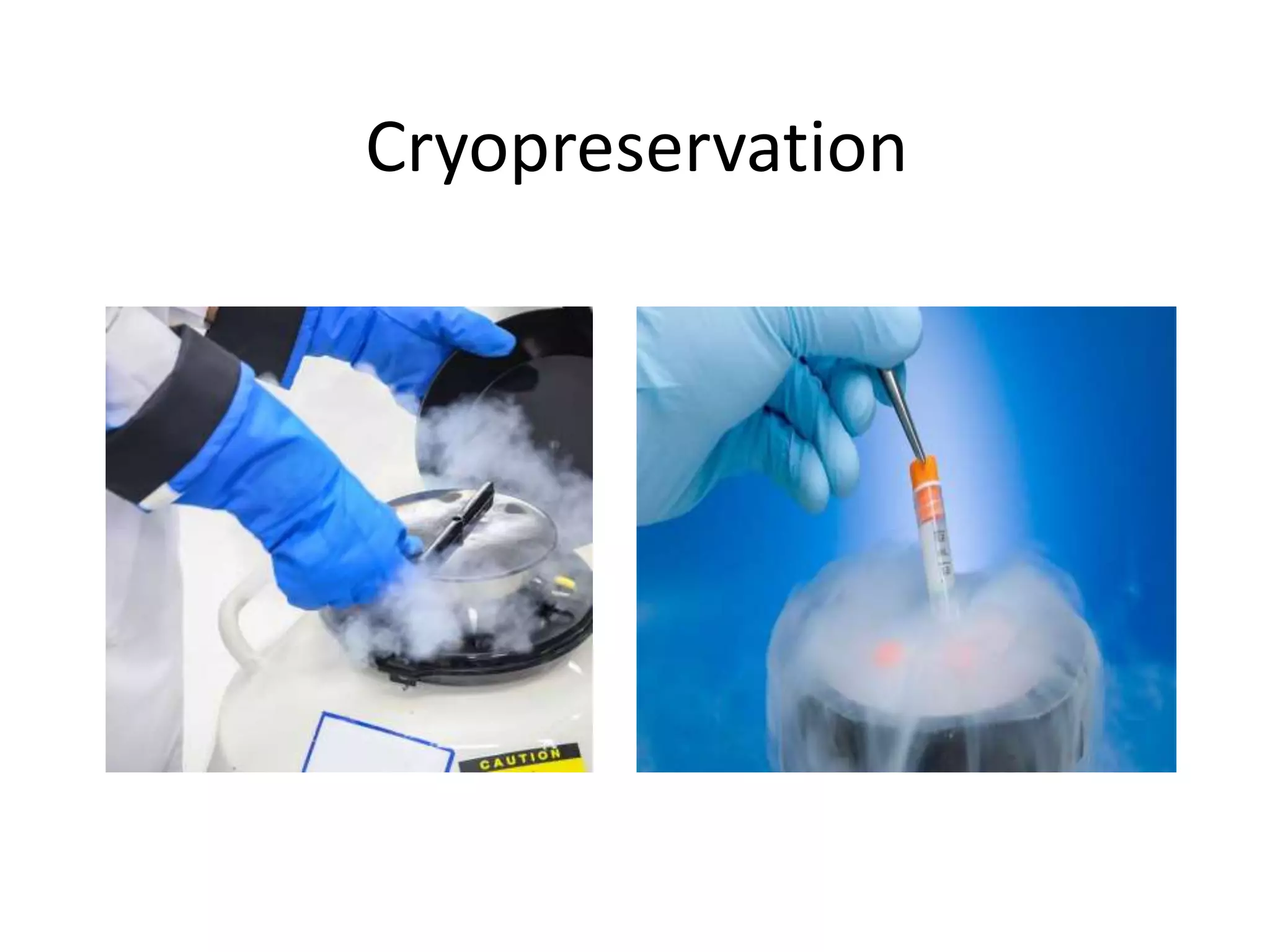 Preservation of Microbial culture.pptx | PPTX