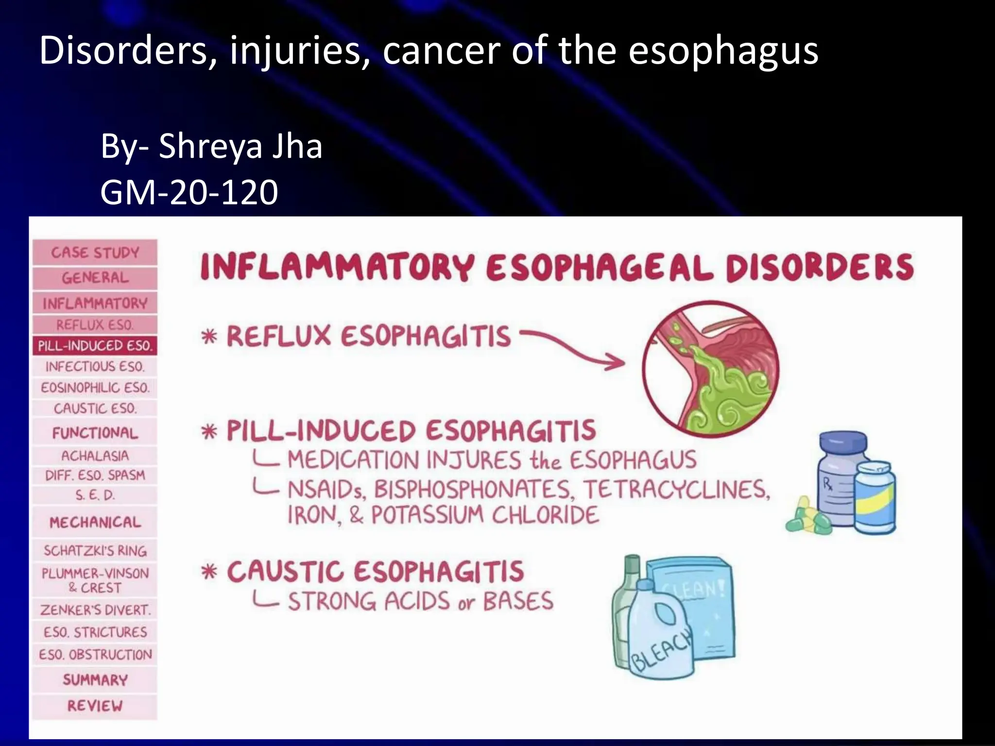 Inflammatory Esophageal Disorders of the | PPT