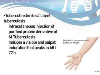 Tuberculosis diagnosis and investigations.pptx