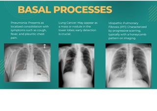 DIFFERENTIAL DIAGNOSIS OF BASAL & PARAMEDICAL PROFESSES, PULMONARY ...