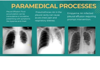 DIFFERENTIAL DIAGNOSIS OF BASAL & PARAMEDICAL PROFESSES, PULMONARY ...