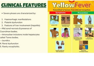 Yellow Fever: Causes, Symptoms, Prevention, and Treatment | PPTX
