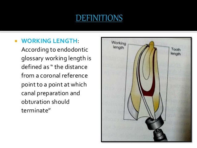 working length