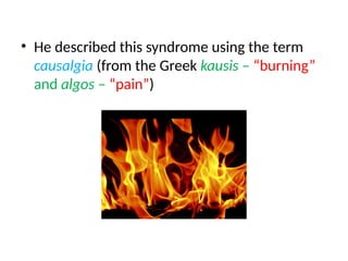 Shoulder hand Syndrome in ortho bkk.pptx