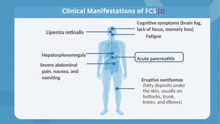 SHTG - FCS 3.pptx familial chylomicronemia and sever hyper ...
