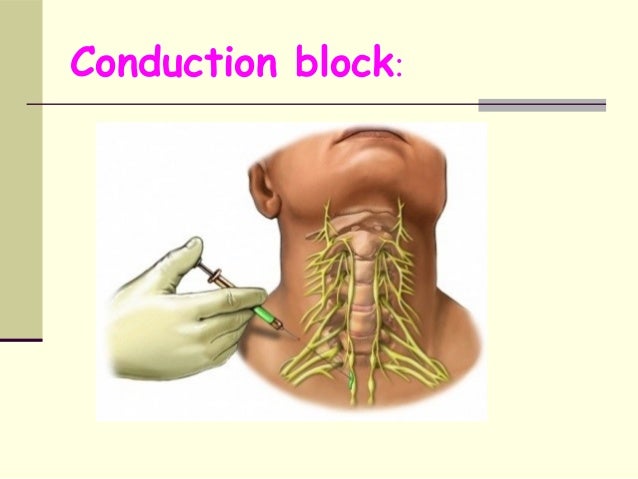 LOCAL AND GENERAL ANESTHESIA